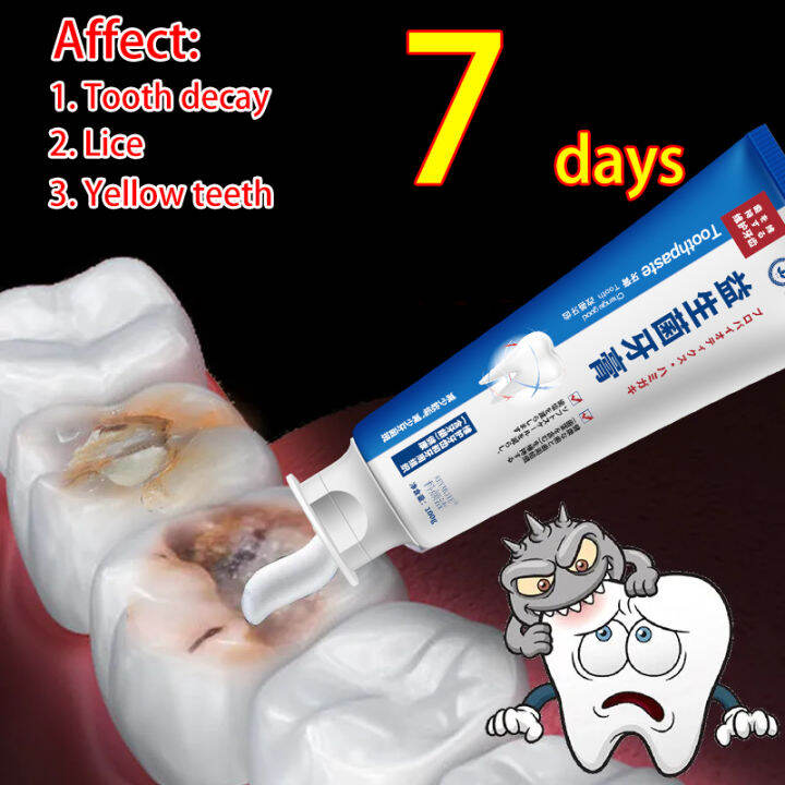 Probiotic toothpaste removes bad breath Helicobacter flavus cavities ...