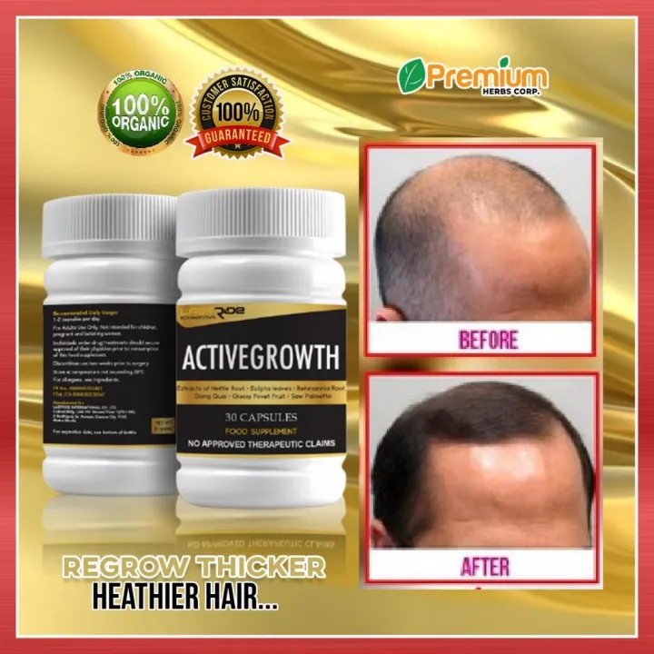 【Hot sale】 Active Growth Hair Grower Castor Oil Novu Minoxidil Shampoo ...