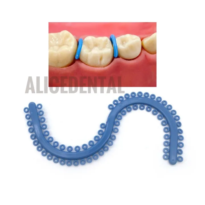 Dental karet elastic separator molar band ring ortho orthodontic type S karet elastik behel ...