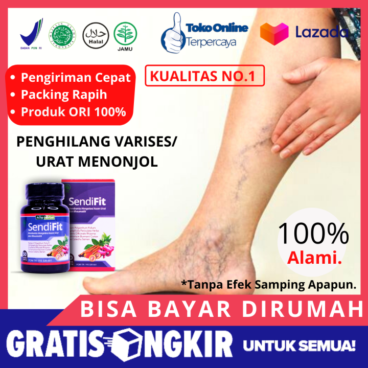 Obat Herbal Varises - Varises Di Kaki, Varises Di Betis, Varises Di ...