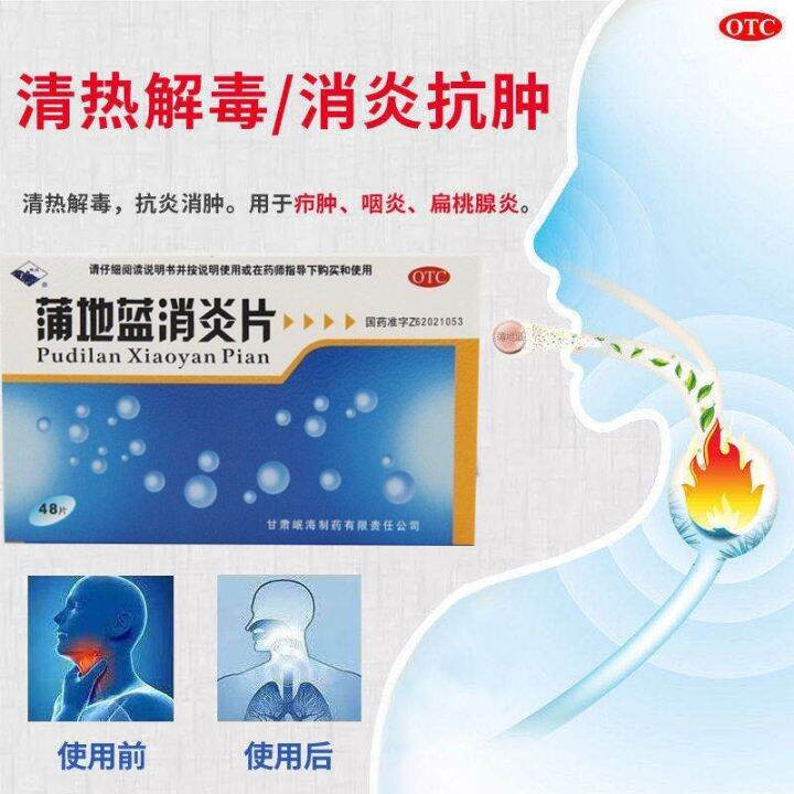 Specializing in tonsillitis sore throat pharyngitis clearing heat ...