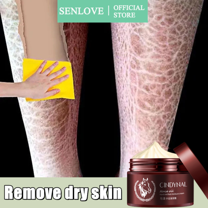 SENLOVE Original horse oil Hand and Foot Salve Cream 110g anti-cracking ...