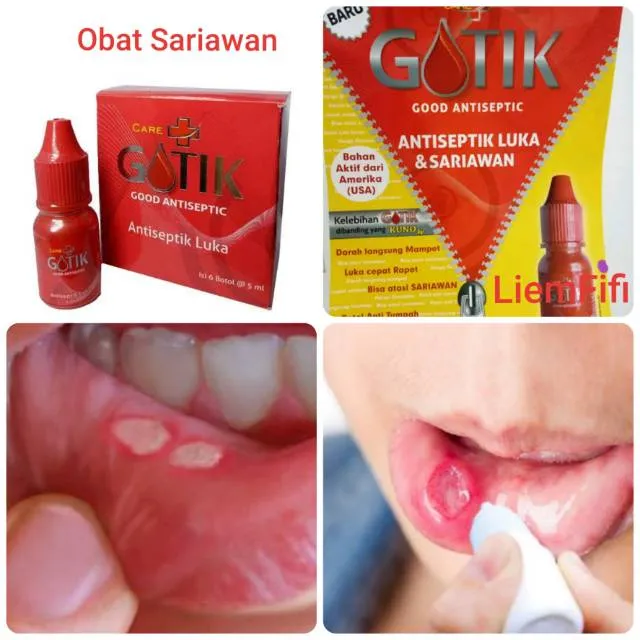 GOTIK Antiseptik Povidone Lodin 10% Obat Luka Sariawan | Lazada Indonesia