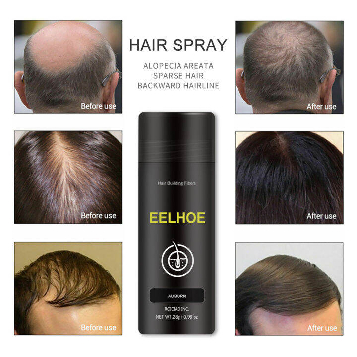 Densifying Hair Powder Spray To Replenish Hairline Black ABS Hair ...