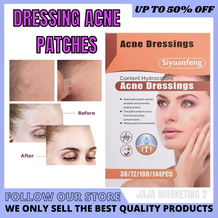 BEST SELLER!! 100 PCS ACNE REMOVER Spot Treatment Patch Acne Cover ...