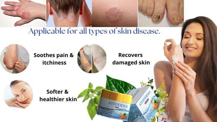 ATODERMA (DERMATITIS, ALERHIYA, PANTAL, URTICARIA, DERMATITIS PLANTARIS ...