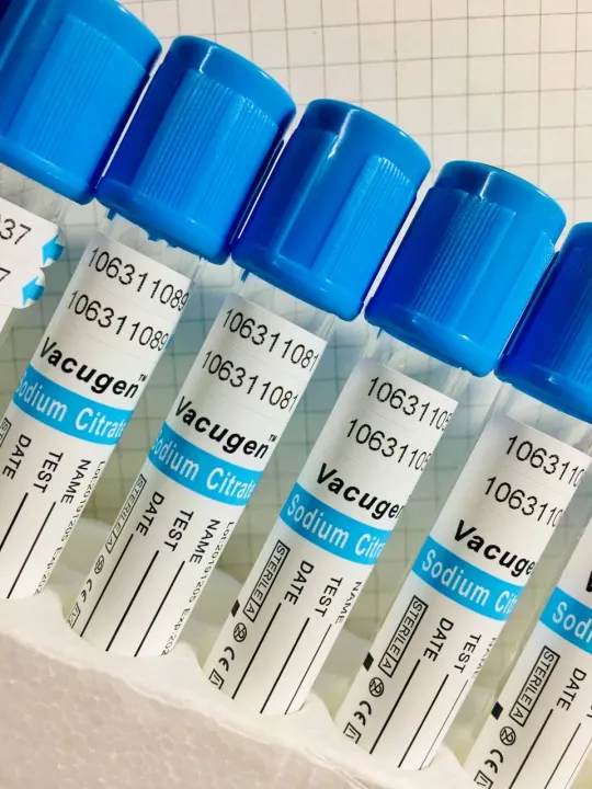Light Blue Vacutainer with Anticoagulant or Vacuum Tube for Veni ...