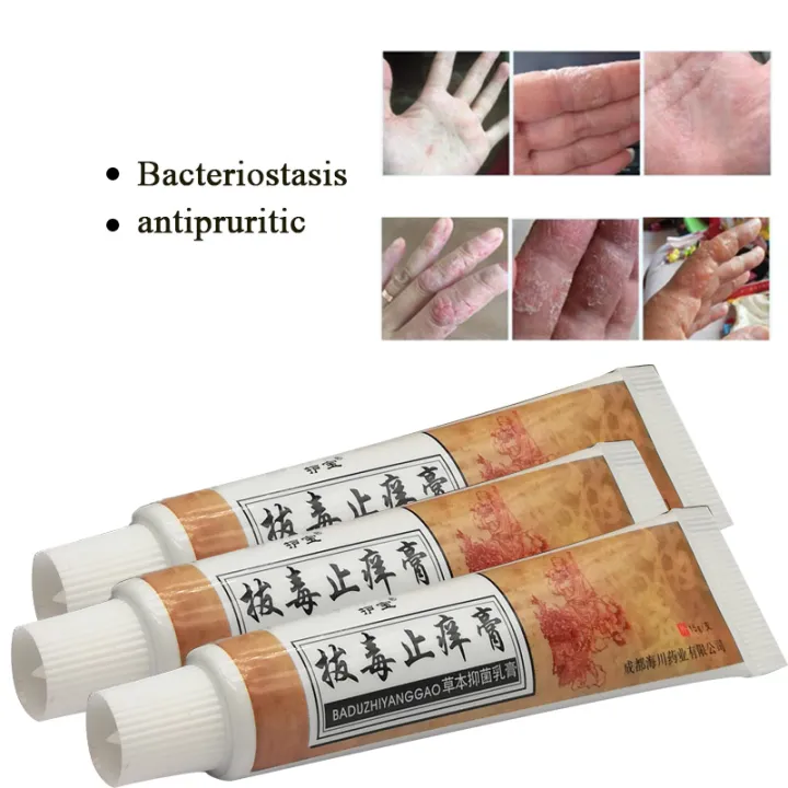 ZB 15g Antipruritic Ointment Mosquito Bites Ointment Skin Itchy Relief ...