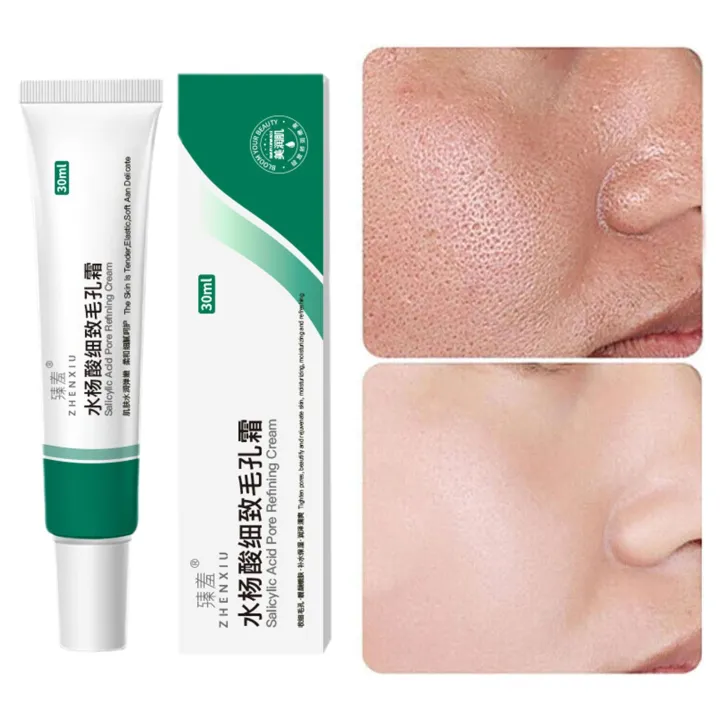 Salicylic Acid Pores Refining Cream Shrink Pore Improve Acnes ...