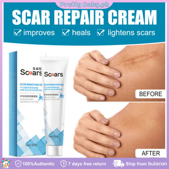 Scar Remover Gel Cream Stretch Marks Removal Ointment Acne Scar Pimples ...