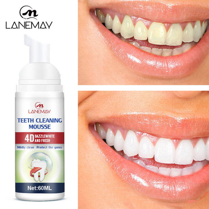 Teeth Whitening Toothpaste Tooth Cleaning Mousse Stain Cleaning Teeth ...