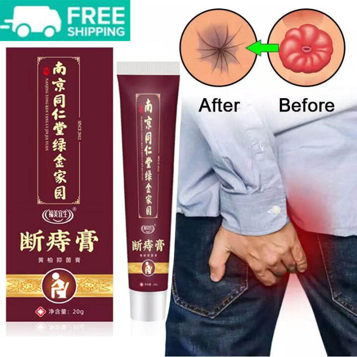 New Plant Herbal Hemorrhoid Cream Internal Hemorrhoids External