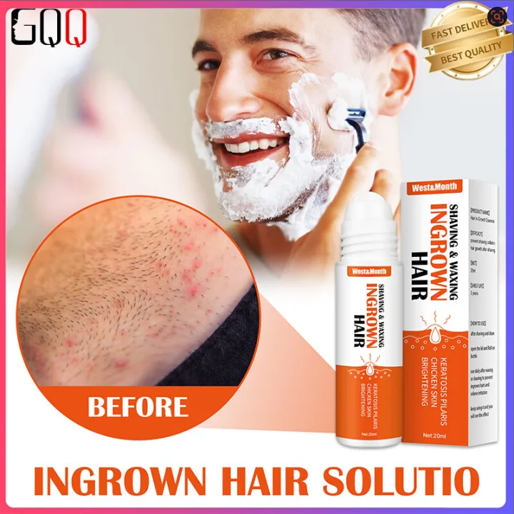 GQQ Anti Ingrown Hair Essence Help Prevent Razor Bumps Ingrown Hair ...