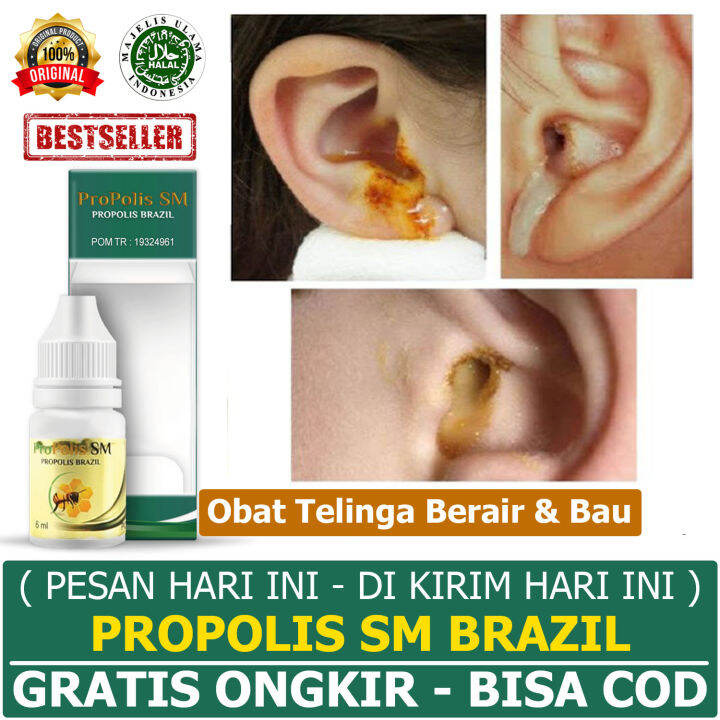 Obat Tetes Telinga Berair dan Bau Congek MenahunTelinga Berdengung ...