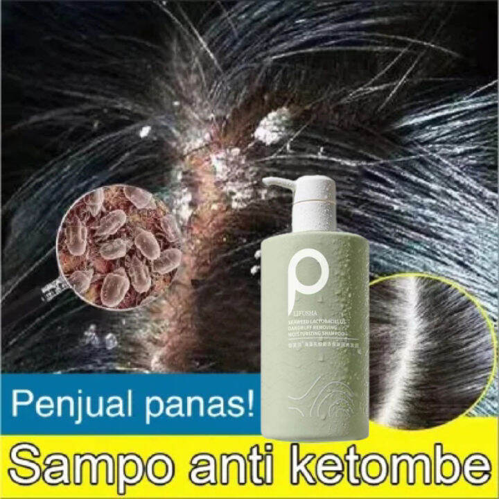 obat ketombe sampo anti ketombe dan gatal shampoo penghilang ketombe sea salt sampo tungau dan ...