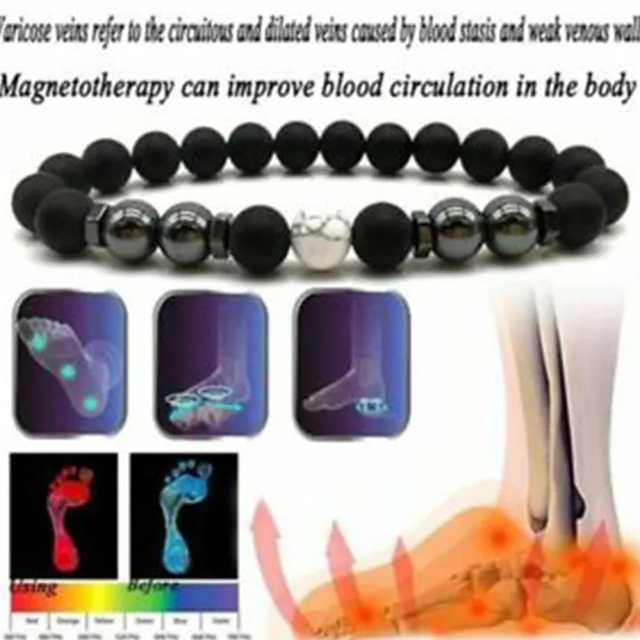 Magnet Anklet Stone Eight Loss Magnetic Therapy Bracelet Jewelry Care ...