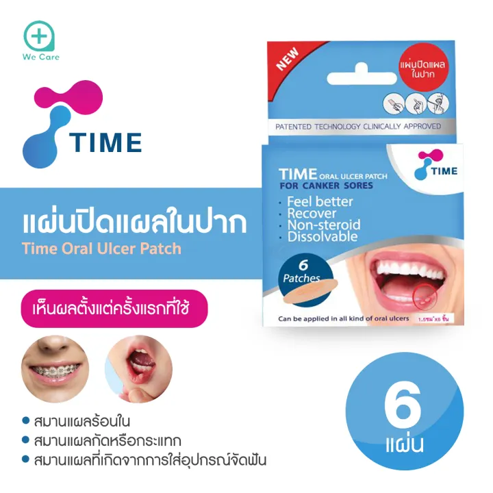 TIME Oral Ulcer Patch แผ่นปิดแผลในปาก ผลร้อนใน แผลกัดหรือกระแทก (1 ...