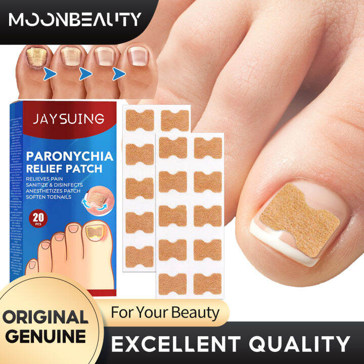 Jaysuing Paronychia Relief Patch Removal Improve Nail Ingrown Correction Stickers Treatment ...