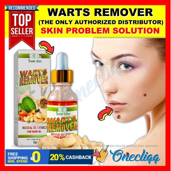 Great Life Warts Remover Ointment Natural Oil Extract Pure Kasoy Oil ...