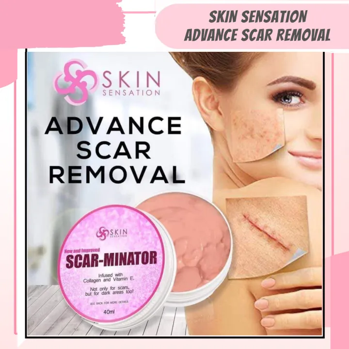 Skin Sensation Original And Effective Scarminator Cream 40g Best Scar
