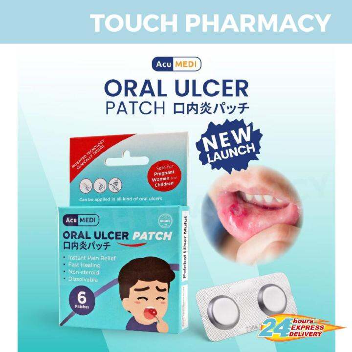 AcuMEDI Oral Ulcer Patch 6's/BOX | Lazada