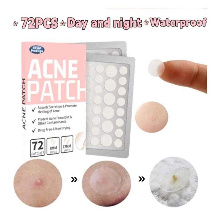72pcs Salicylic Pimple Patch Invisible Acne Stickes Skin Tool Beauty ...