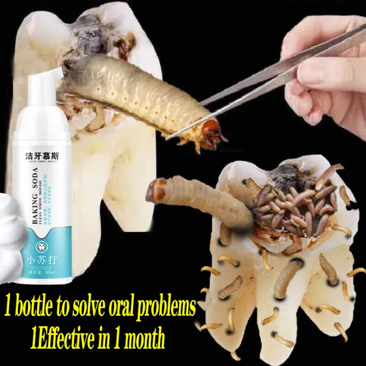 🎁buy 1 get 1 free COD teeth whithening clean teeth tartar original ...