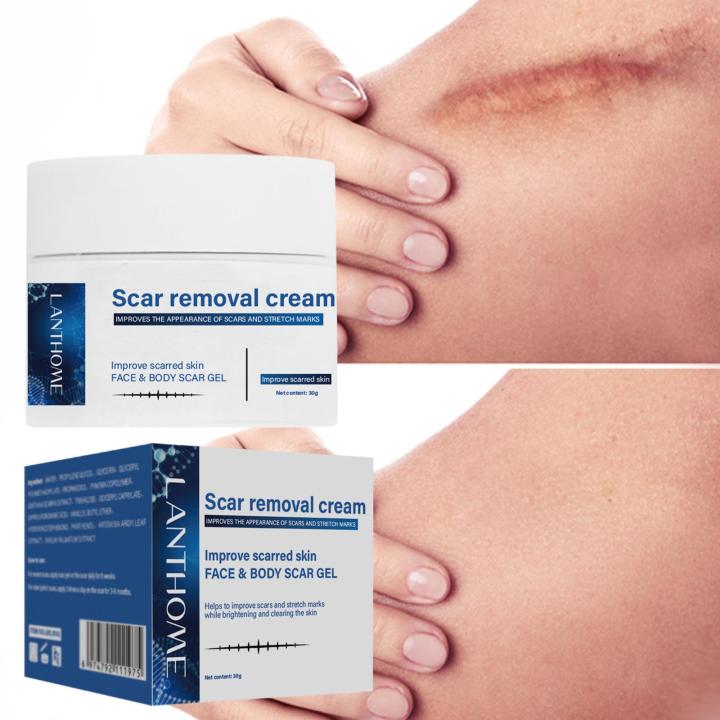 Body Cream Light Scar Cream Soothing Repair Cream V2A4 | Lazada PH