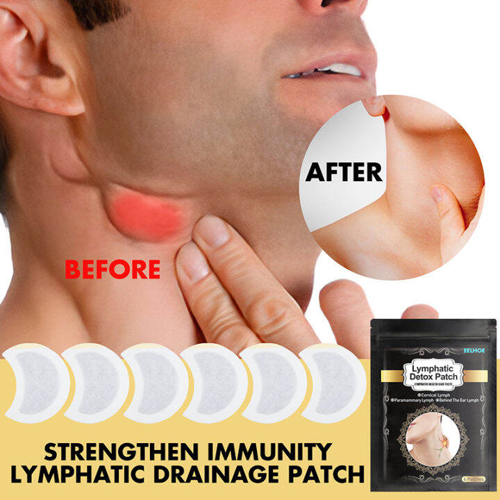 6Pcs/Bag Lymph Nodes Detox Patch Underarm Chest Neck Lymphatic Drainage ...