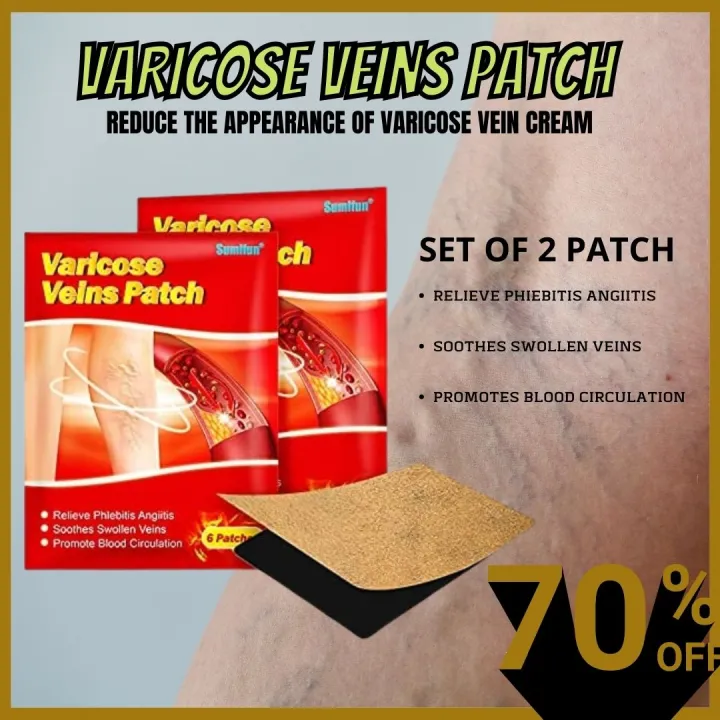 [ HIGH QUALITY ] Varicose Veins Patch Relief Plaster Chinese Herbal ...