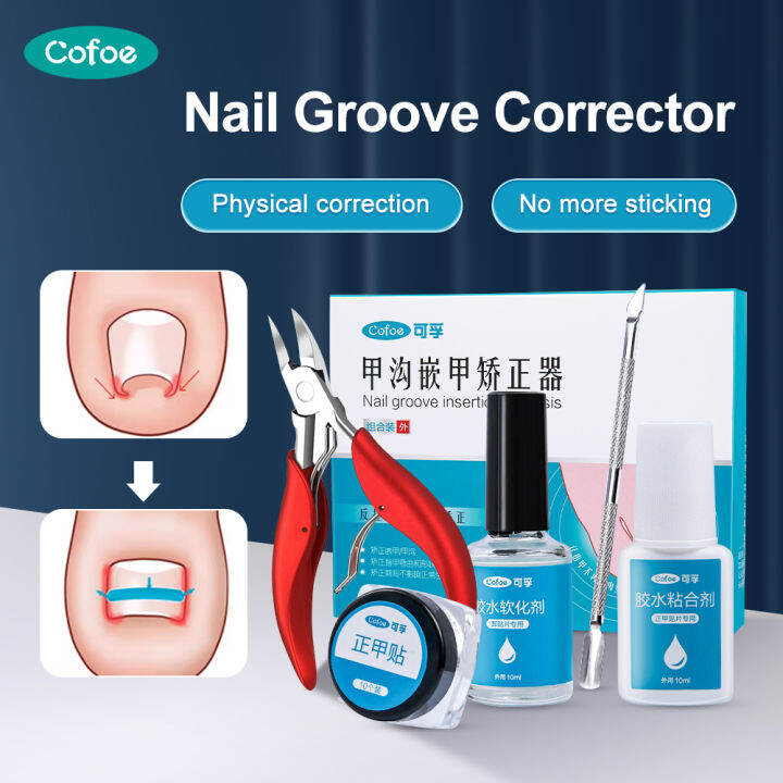 Cofoe Toe Nail Straightening Sticker Nail Groove Corrector Toe Nail ...