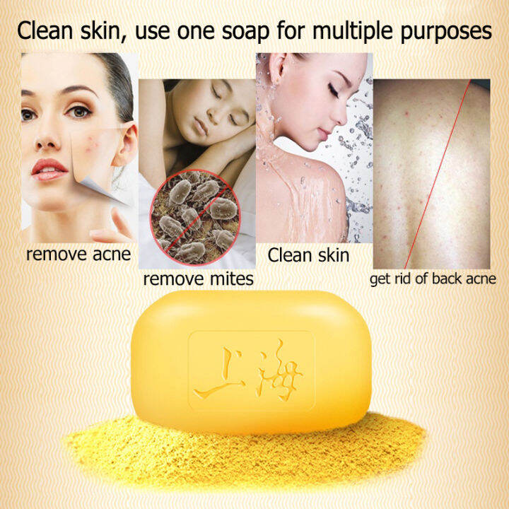 Shanghai Sulfur Soap To Remove Mites Eliminate Acne On The Face and ...
