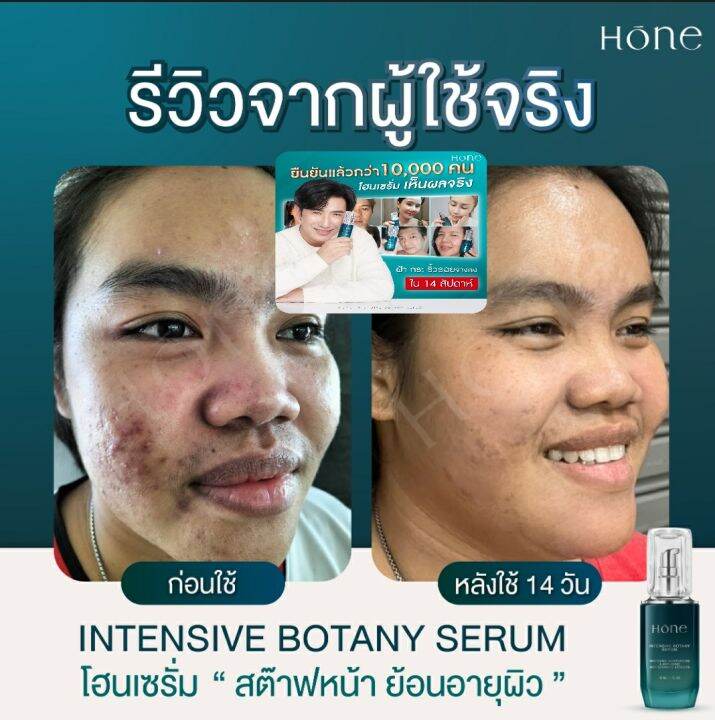 Hone Serum Facial Baby Face Korean Kornchai Beautiful smooth skin muka cantik licin 美容漂亮美丽润滑 ...