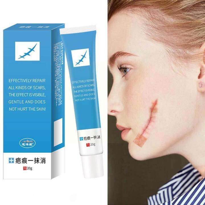 Scar repair cream caesarean section bump scars scars acne marks to ...