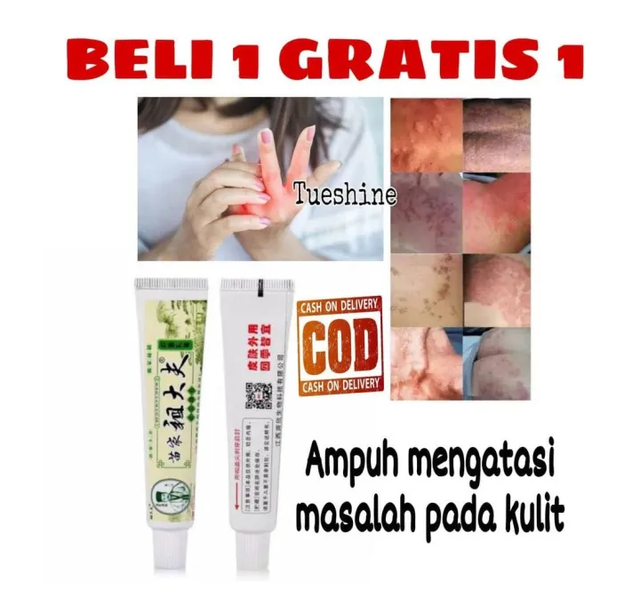 BELI 1 GRATIS 1 - SALEP GATAL BERKHASIAT - SALEP ALERGI AMPUH - SALEP ...