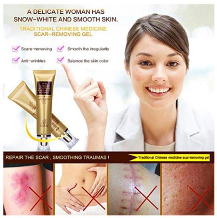 Original TCM Scar Remover | Lazada PH