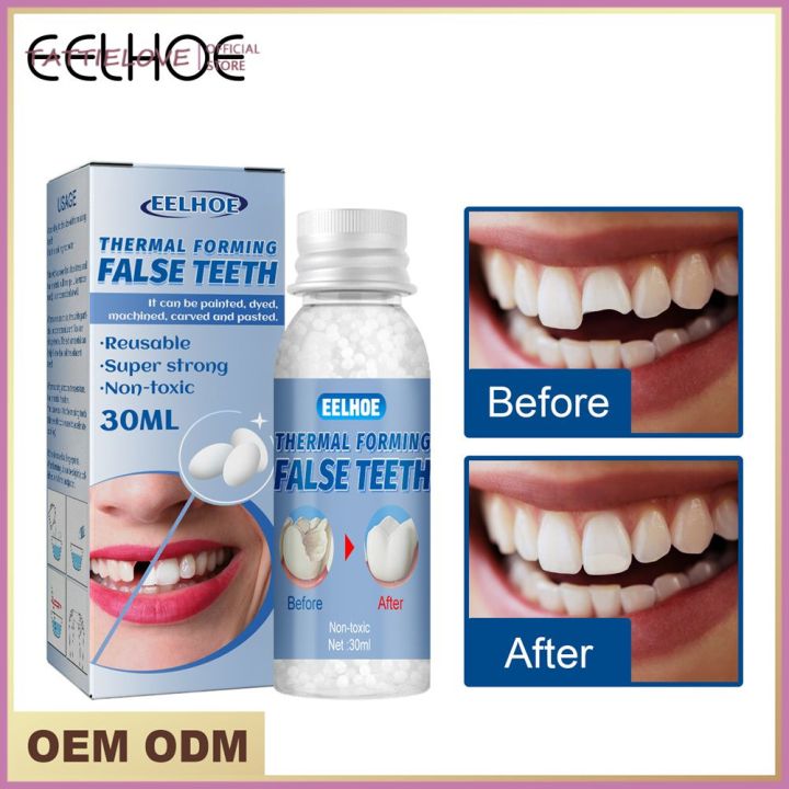 Eelhoe -10ML/20ml/30ml Denture Solid Glue Dental Restoration Temporary ...