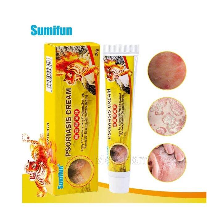 Sumifun Psoriasis Cream 20g Treat Skin Diseases Such As Psoriasis