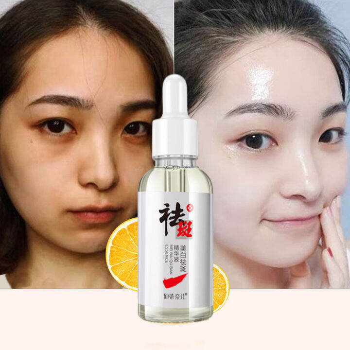 Serum Remove Freckle Fade Dark Spot Anti-aging Whiten Moisturize Facial Serum Aichun beauty ANTI ...