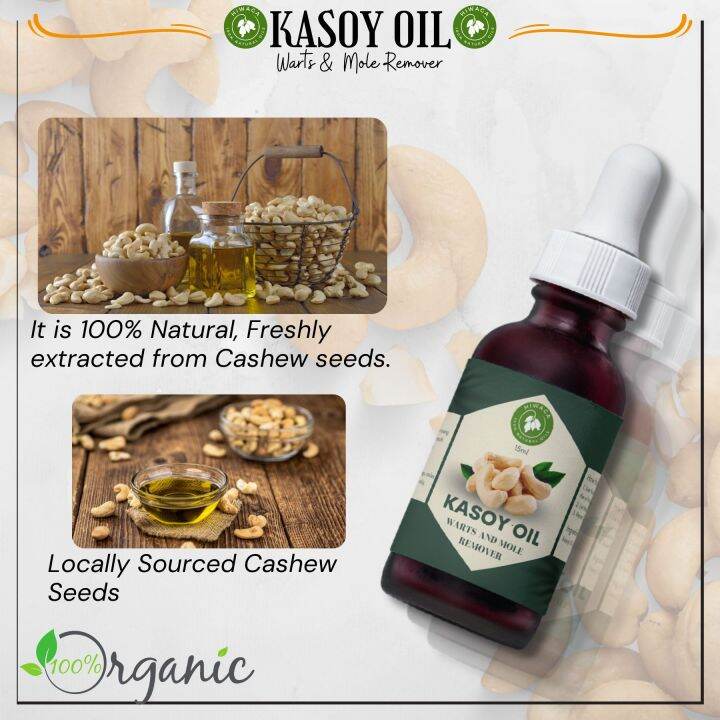 [HIWAGA]Organic & Natural Kasoy Oil(15ml) Remover of Warts, Skin Tags ...