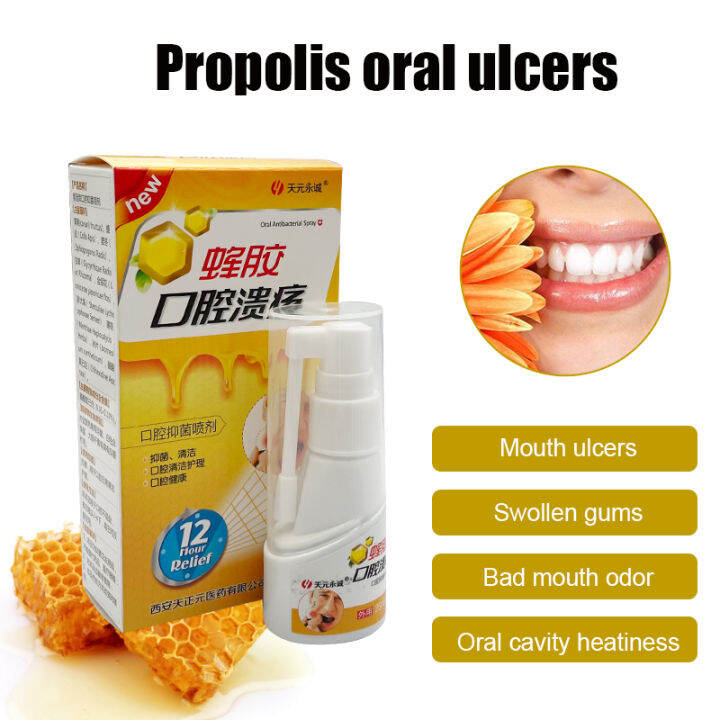 25ml/box Natural Herbal Antibacterial Oral Spray Mouth Freshener Spray ...