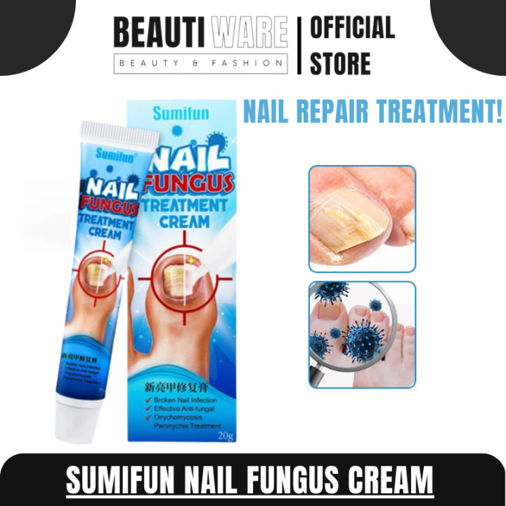 100% Original 20g Sumifun Nail Fungus Treatment Cream Onychomycosis Removal Ointment Fungal ...