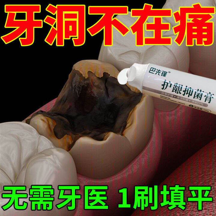 Toothpaste for repairing cavities [the slowest 2 days] Toothpaste for ...