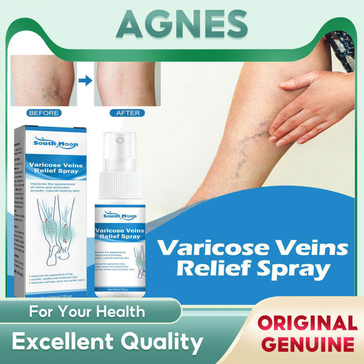 South Moon Varicose Vein Spray Cure Redness Vasculitis Circulation ...