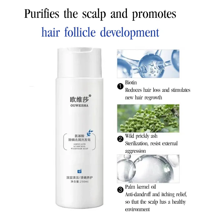 Amino acid oil control anti-dandruff anti-mite itching relief shampoo | Lazada PH