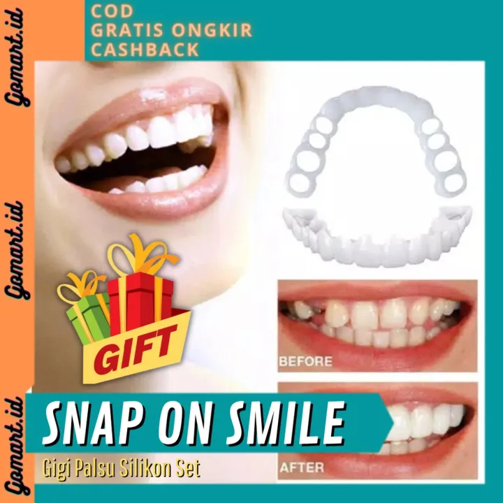 Snap On Smile Venners Gigi Palsu 1 Set Atas Dan Bawah Perfect Smile Menutupi Gigi Ompong Gigi ...