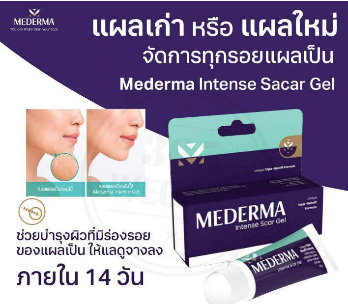 MEDERMA Intense Gel 20 G มีเดอร์ม่า เจล สำหรับรอยแผลเป็น รอยดำจากสิว ...
