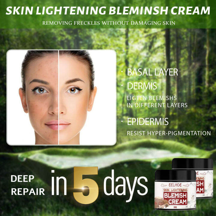 melasma and pekas remover cream original from japan hydroquinone cream ...