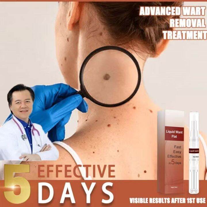 【COD】 warts remover original cream skin tag organica mole removal ...