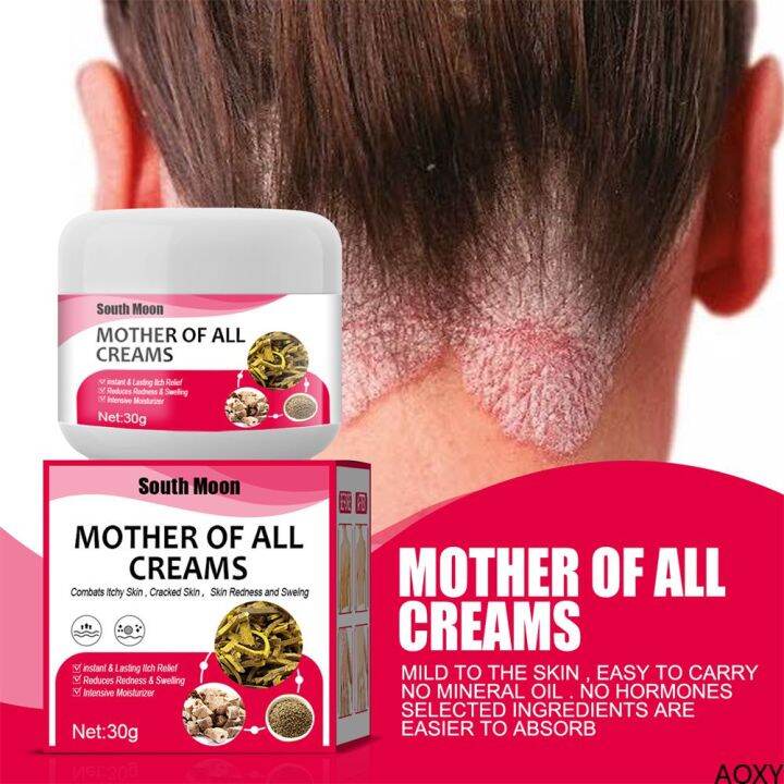 Antibacterial Cream Skin Psoriasis Cream Dermatitis Eczematoid Eczema